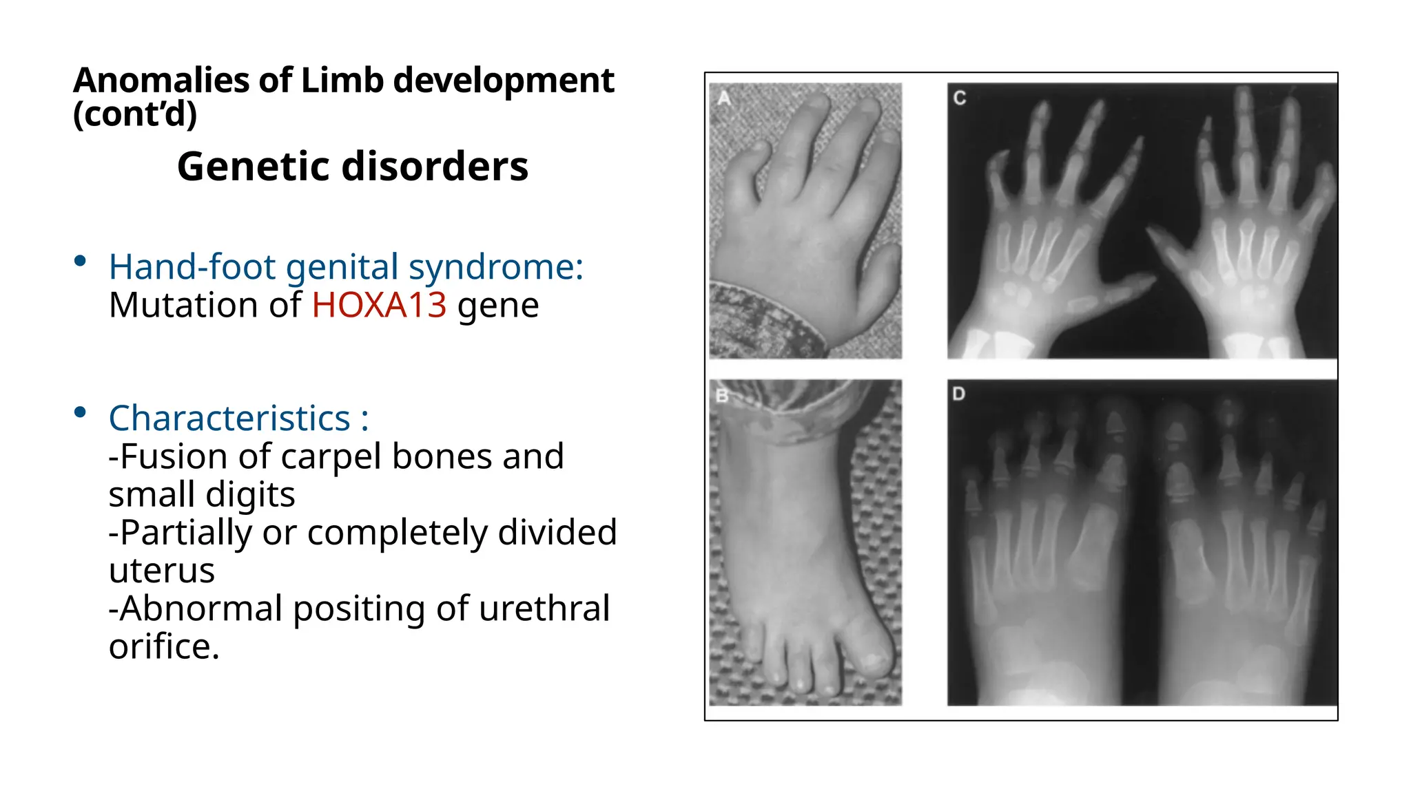 Development of Upper Limb: clear, systematic overview of the ...