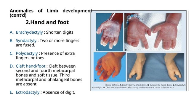 Development of Upper Limb: clear, systematic overview of the ...