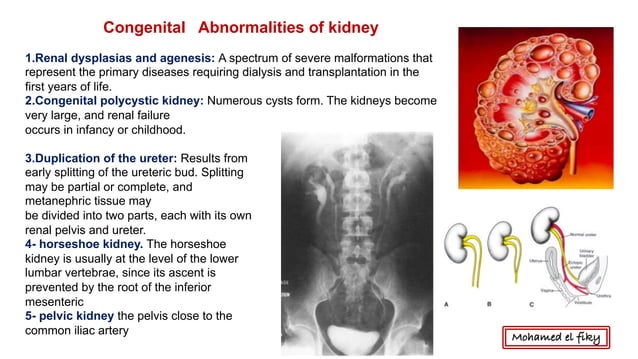 Development of urinary system | PDF | Biological Sciences | Science
