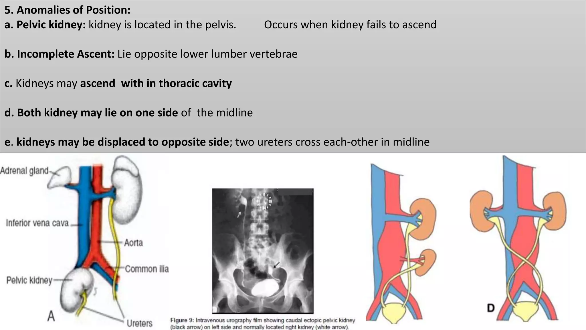 Development Of Urogenital System I Pptx Biological Sciences Science