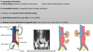Development of urogenital system I | PPTX