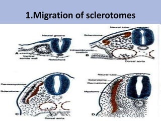 Development Of Vertebral Column | PPTX