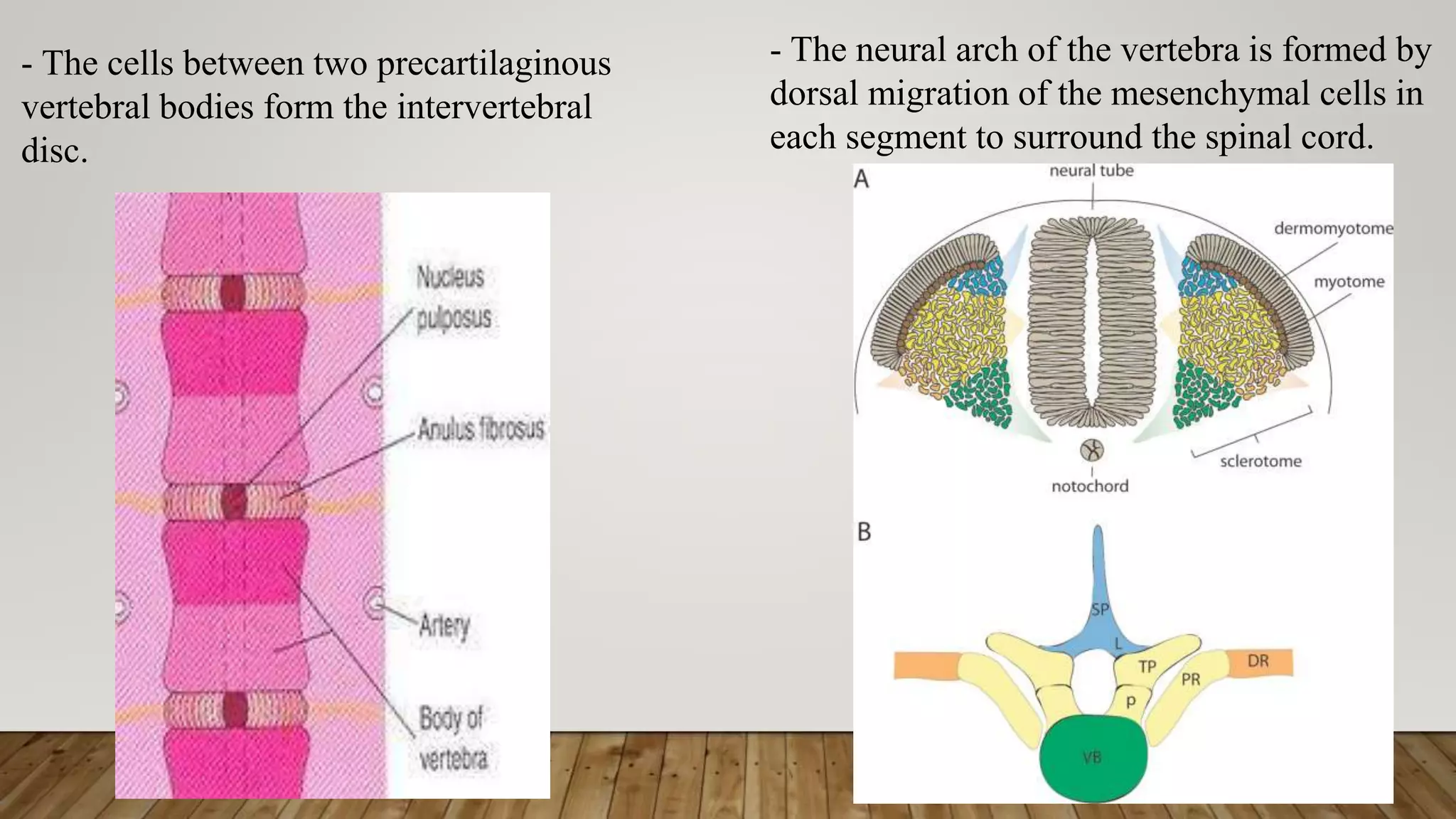 Development Of Vertebral Column Pptx
