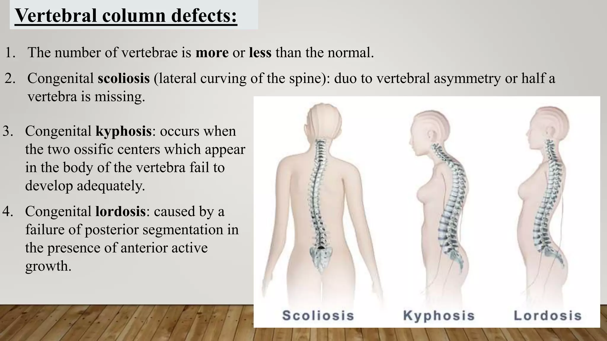 development of vertebral column.pptx