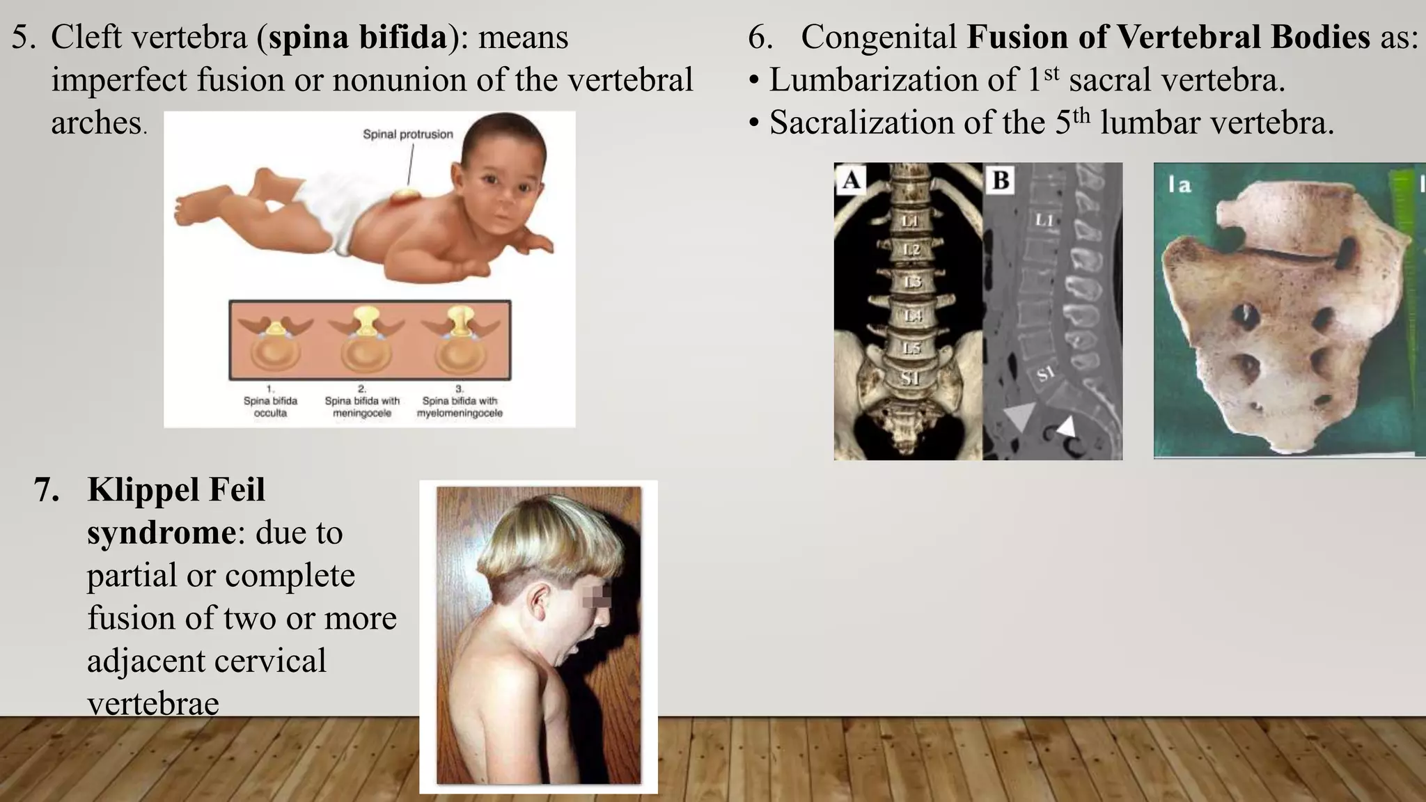 development of vertebral column.pptx