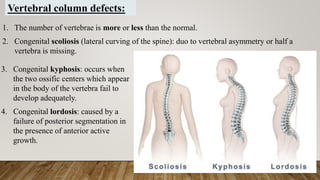 development of vertebral column.pptx