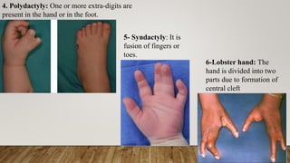 development of vertebral column.pptx