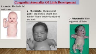 development of vertebral column.pptx