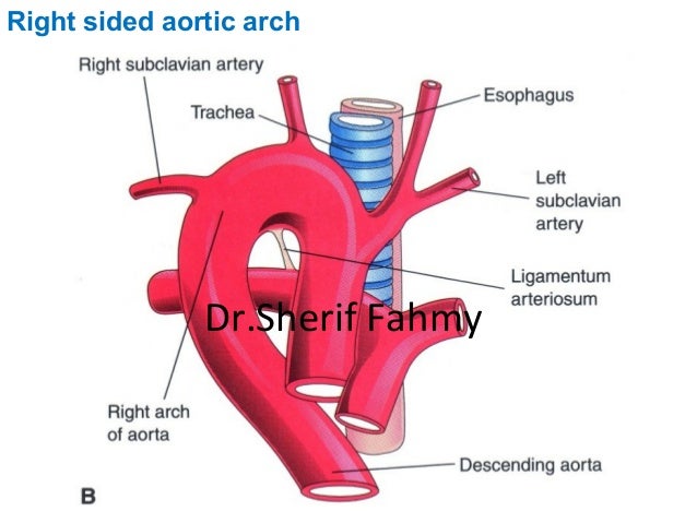 Development of Vessels (Special Embryology)