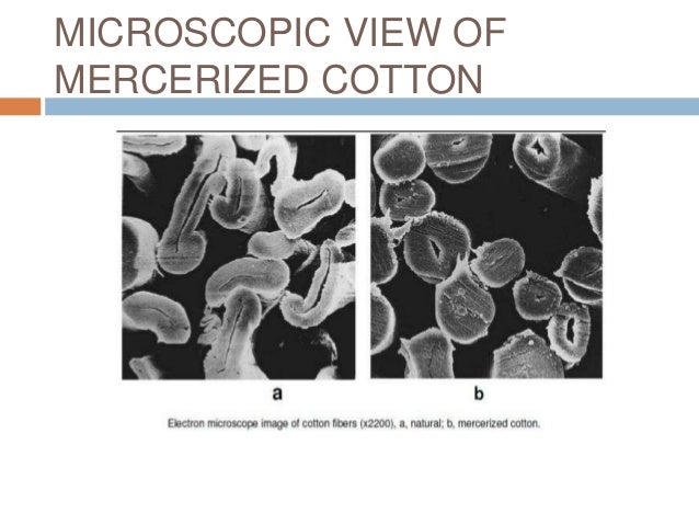 Developments in mercerization3
