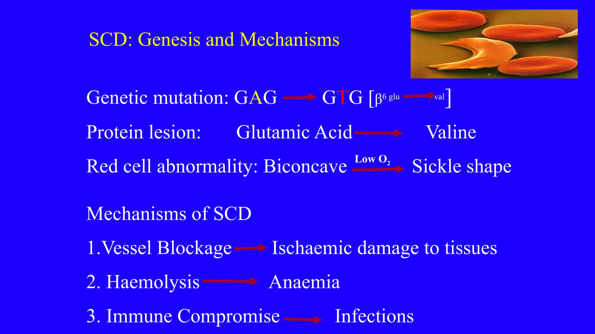 Developments in the Care of People Living with Sickle Cell Disease.pptx