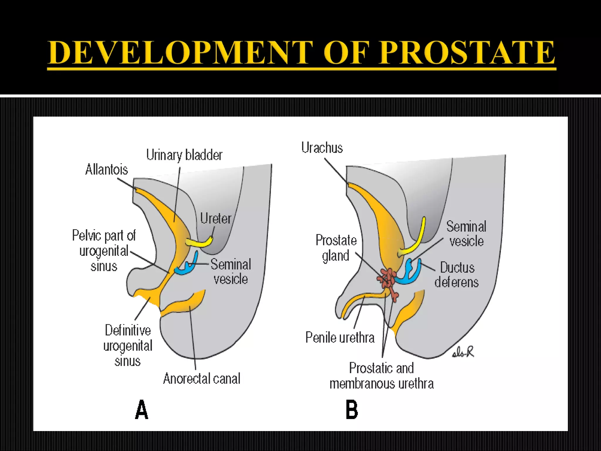 Development & structure of prostate By Dr. Tatheer | PPT