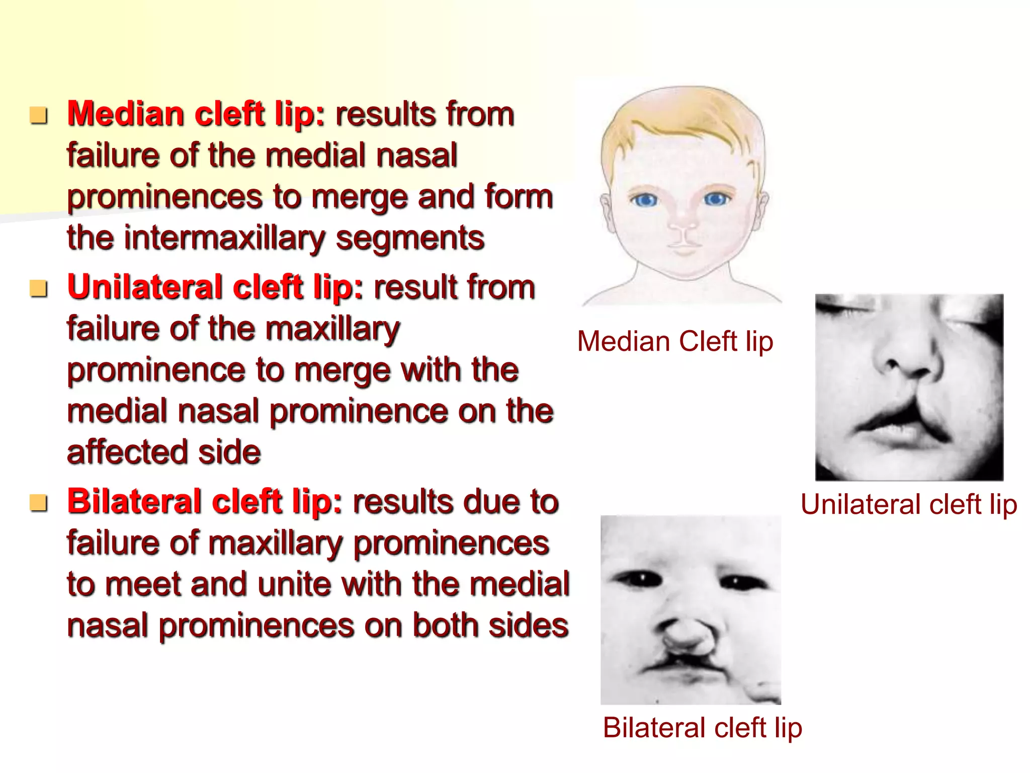 Developm of head and neck prof hosam 1440 copy | PPT