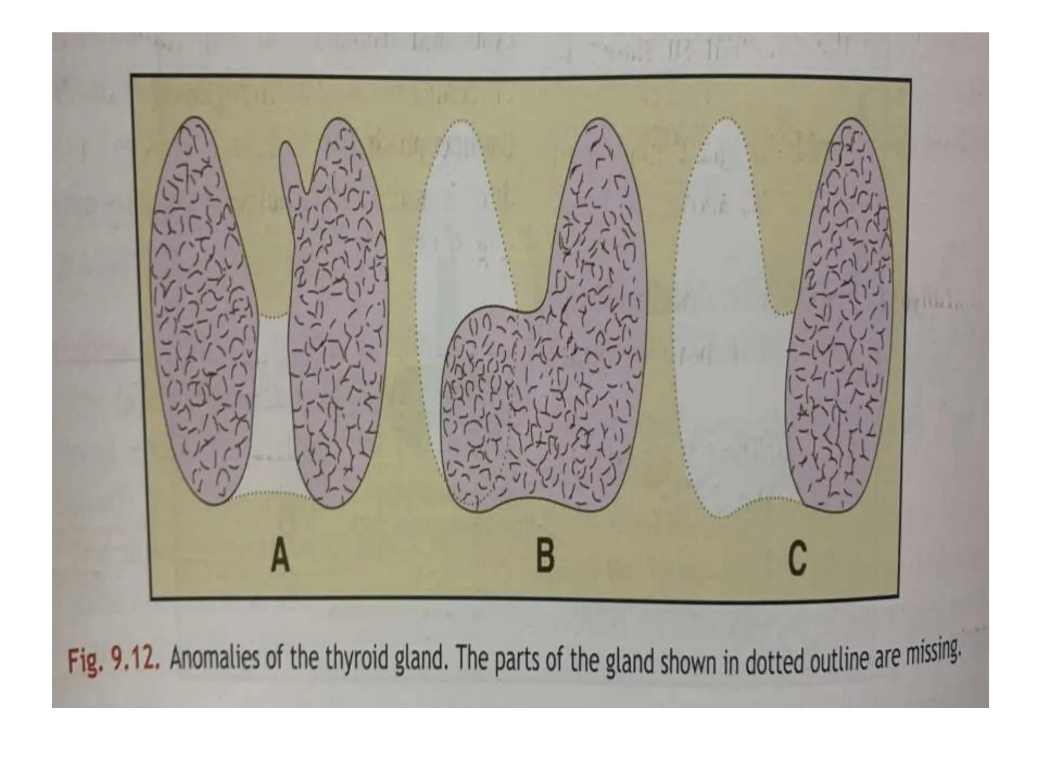 development of thyroid gland.pptx anatomy | PPTX