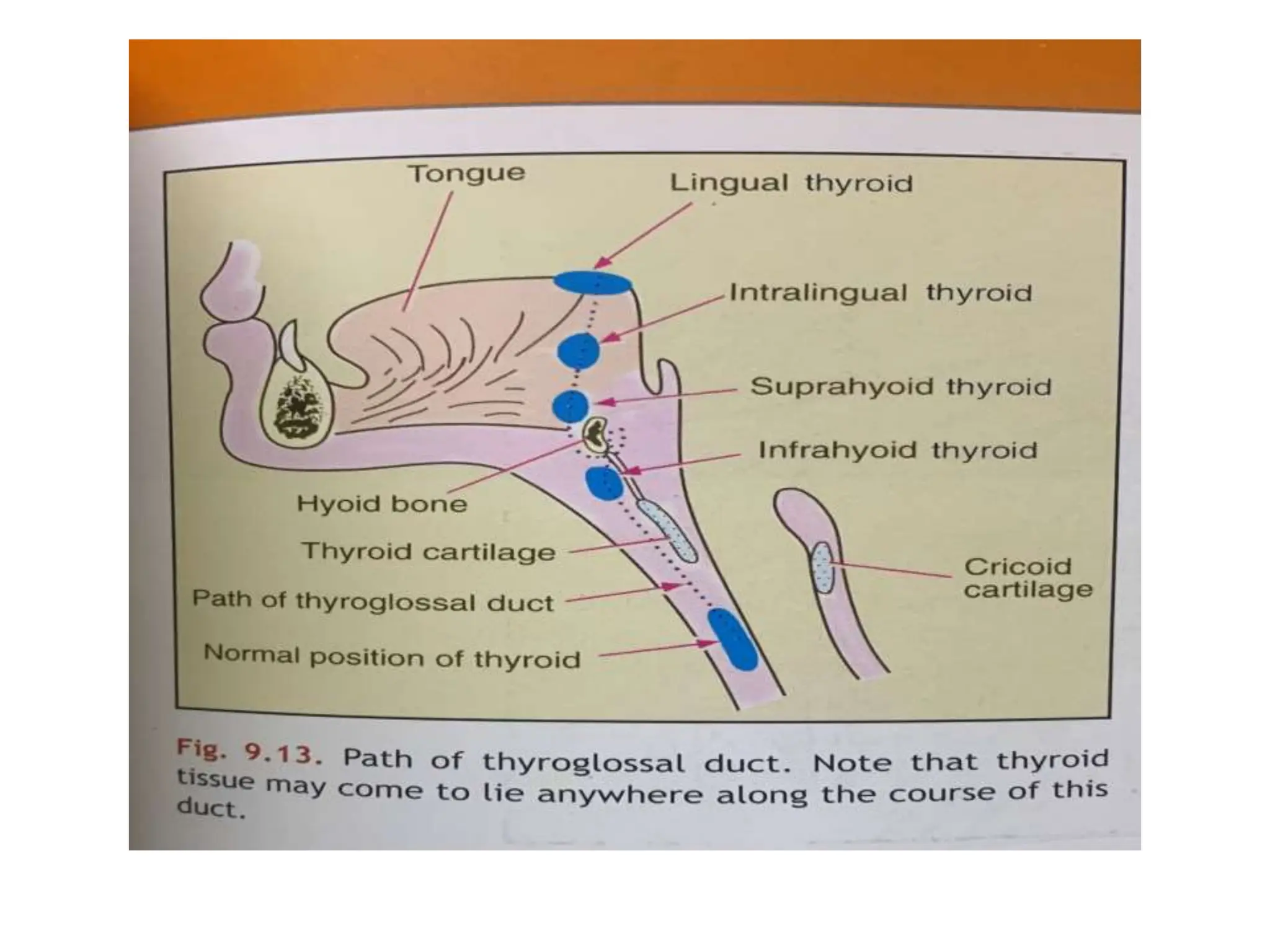 development of thyroid gland.pptx anatomy | PPTX