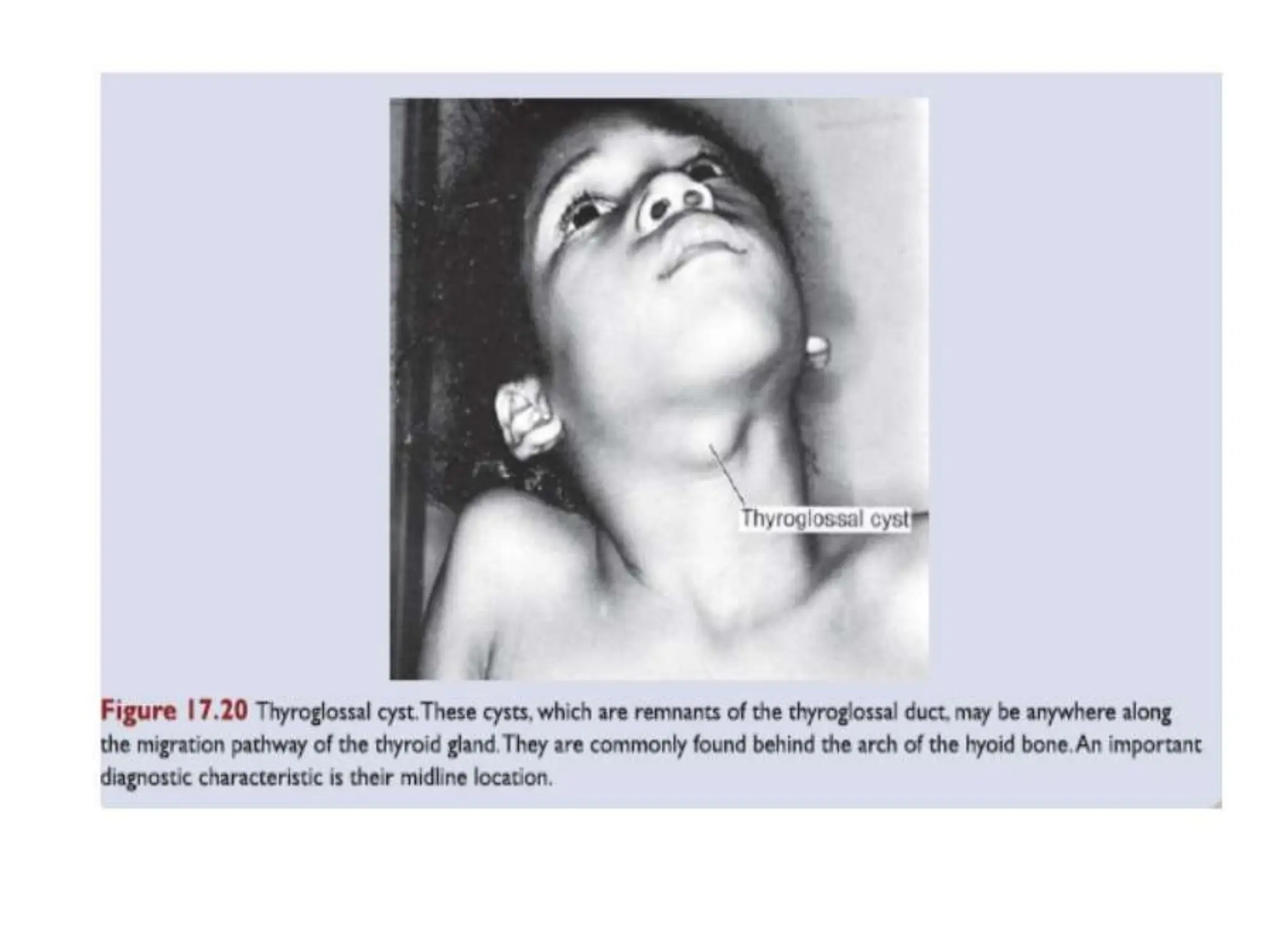 Development Of Thyroid Gland Pptx Anatomy Pptx