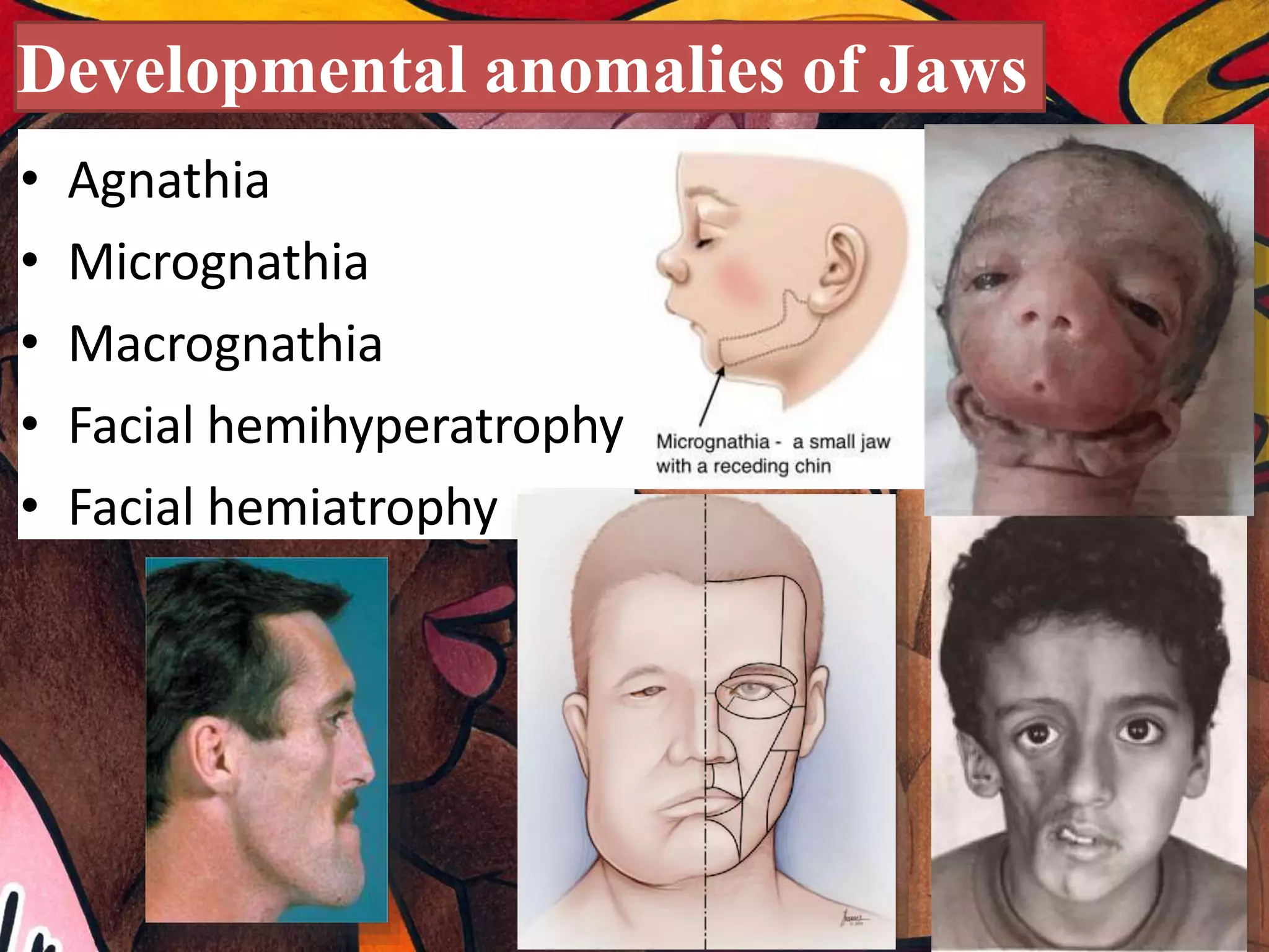 DEVELOPMENT OF FACE | PPTX