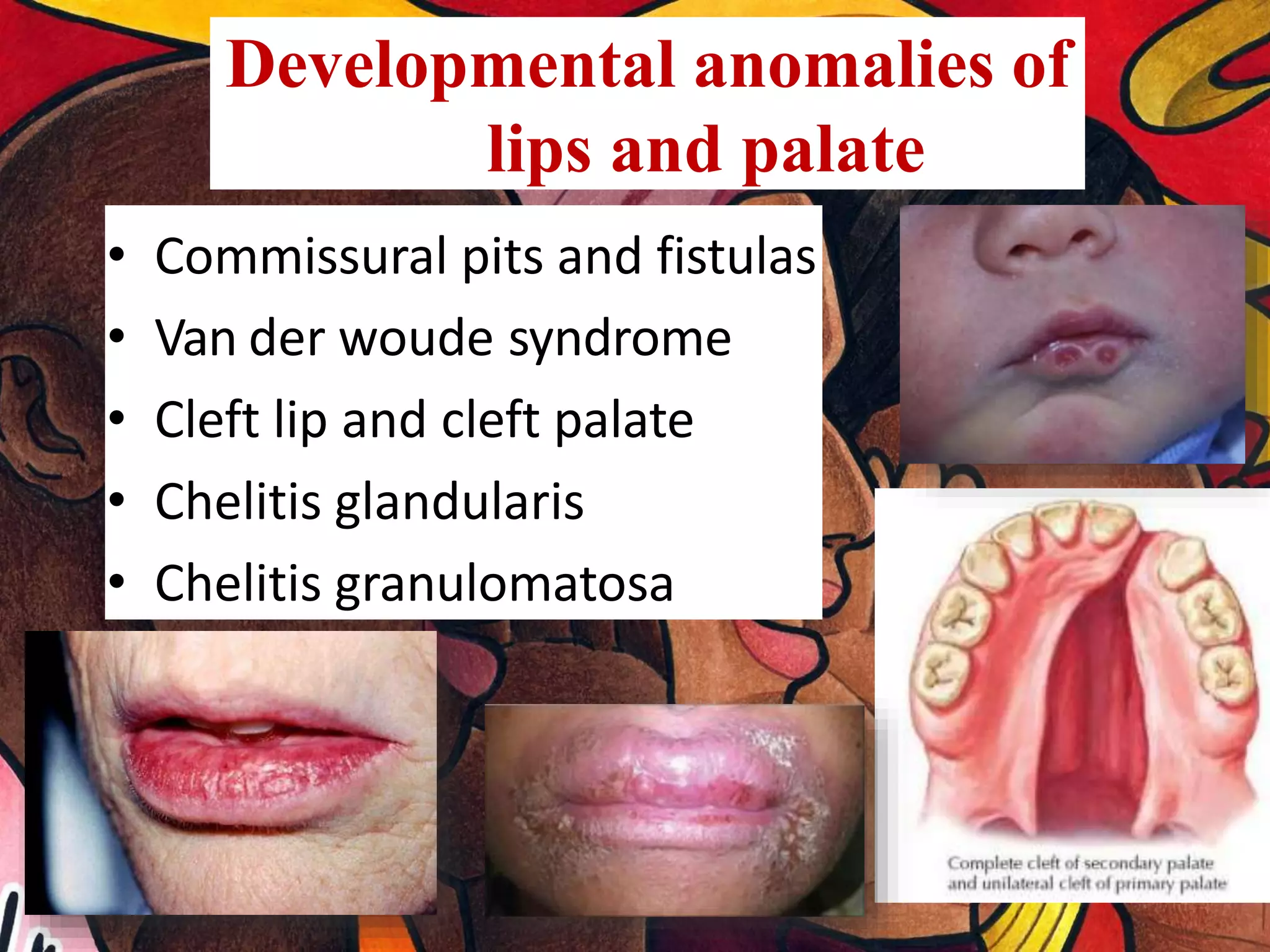 DEVELOPMENT OF FACE | PPTX