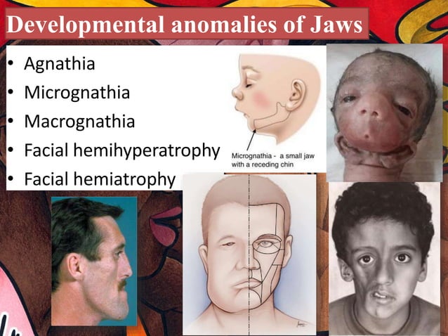 DEVELOPMENT OF FACE | PPTX
