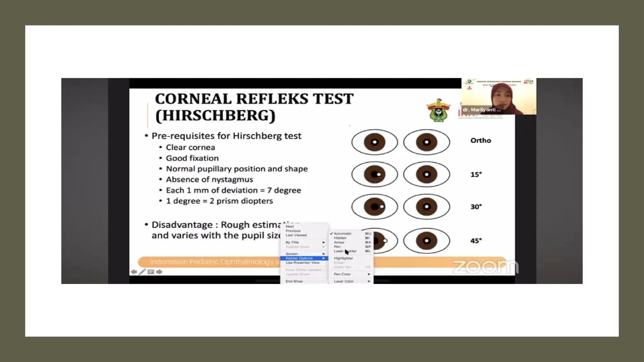 Deviasi Bola Mata. Strabismus Manifest (Tropia) : Cover test Strabismus ...