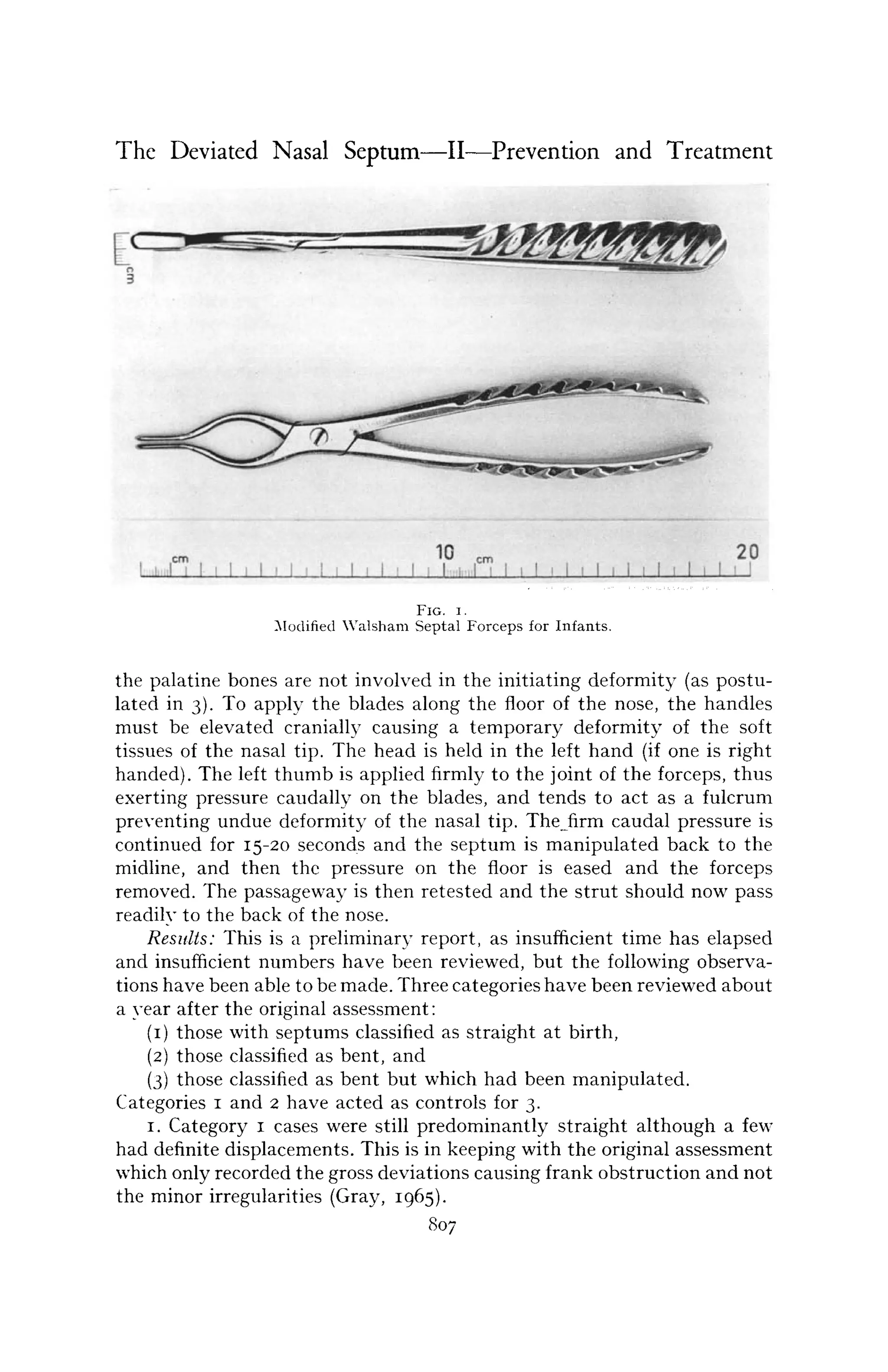 Deviated Nasal Septum | PDF