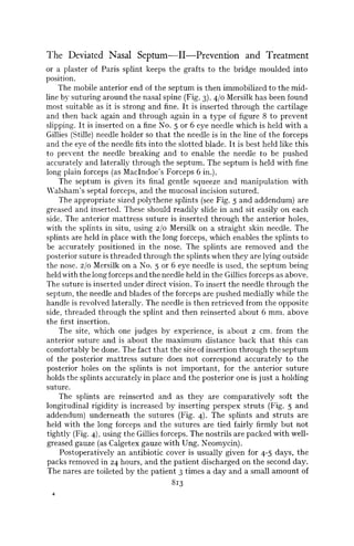 Deviated Nasal Septum | PDF