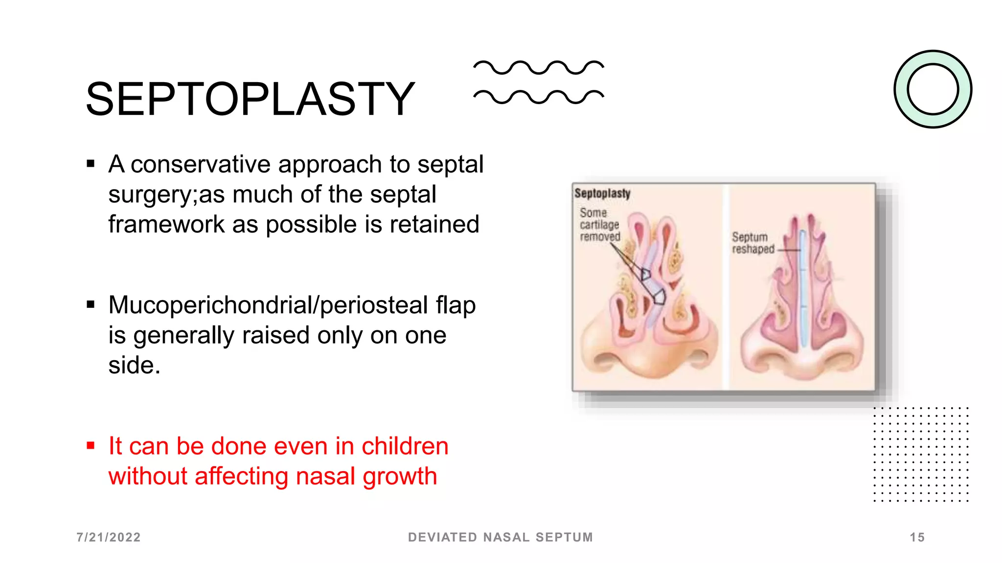 Deviated Nasal Septum.pptx