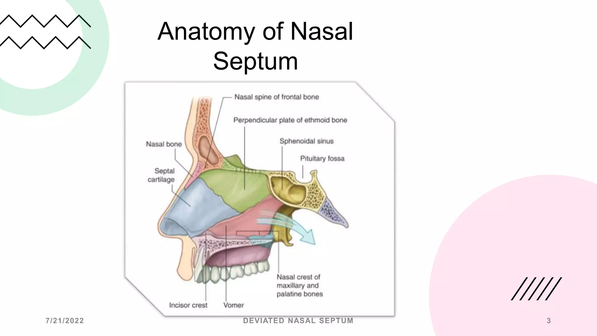 Deviated Nasal Septum.pptx