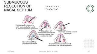 Deviated Nasal Septum.pptx