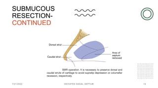 Deviated Nasal Septum.pptx