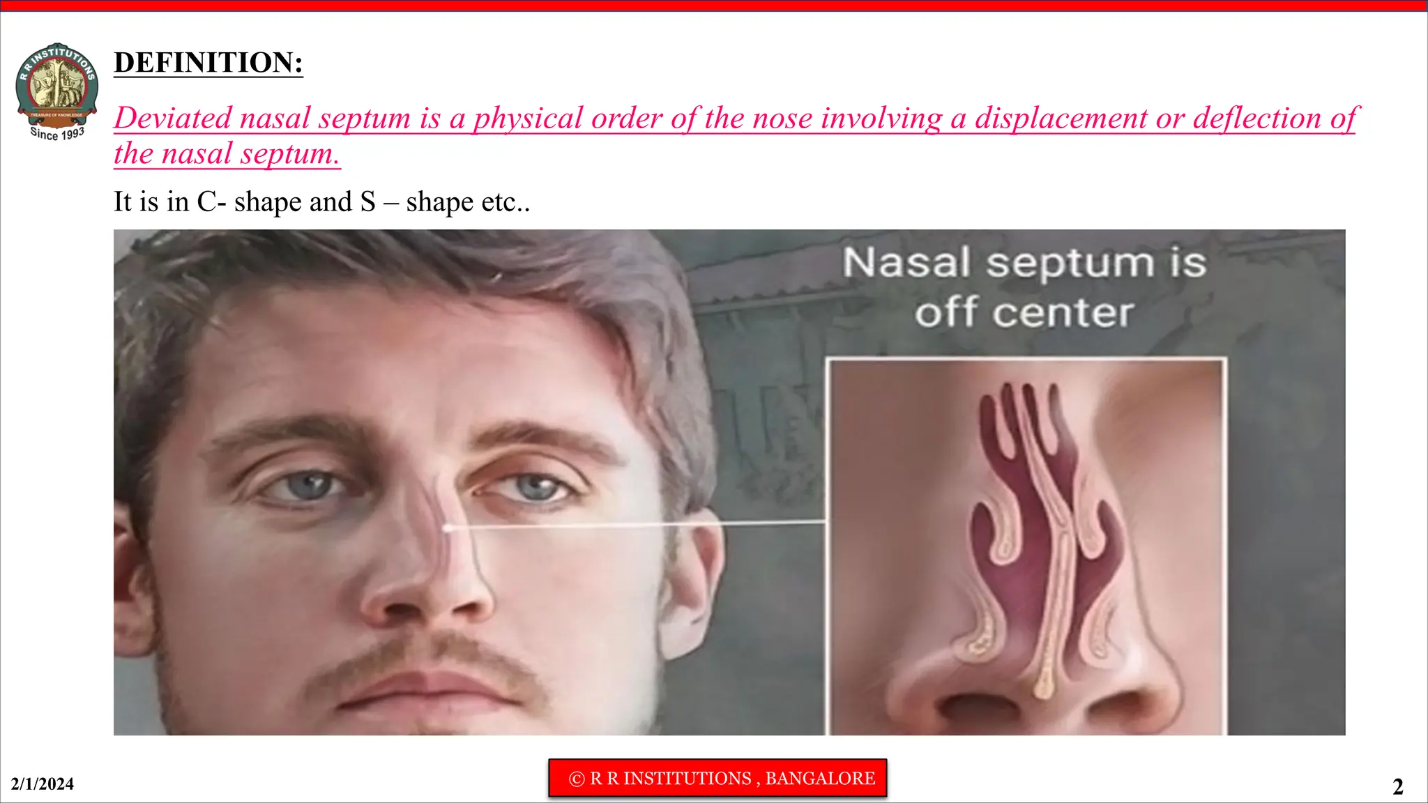 DEVIATED NASAL SEPTUM AND ITS MANAGEMENT.pdf