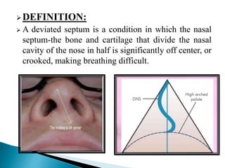 DEVIATED NASAL SEPTUM BY BHUMIKA.G.THAKOR | PPTX