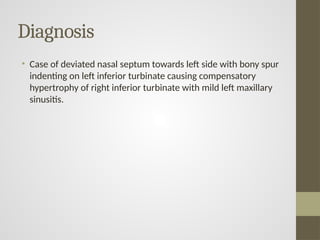 Deviated Nasal Septum 2.pptx mbbs third proff | PPTX