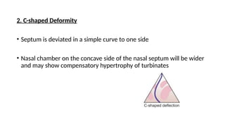 Deviated Nasal Septum DNS ENT Topic.pptx