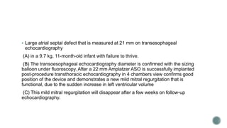 Cardiac catheterization DEVICE CLOSURE OF ASD.pptx