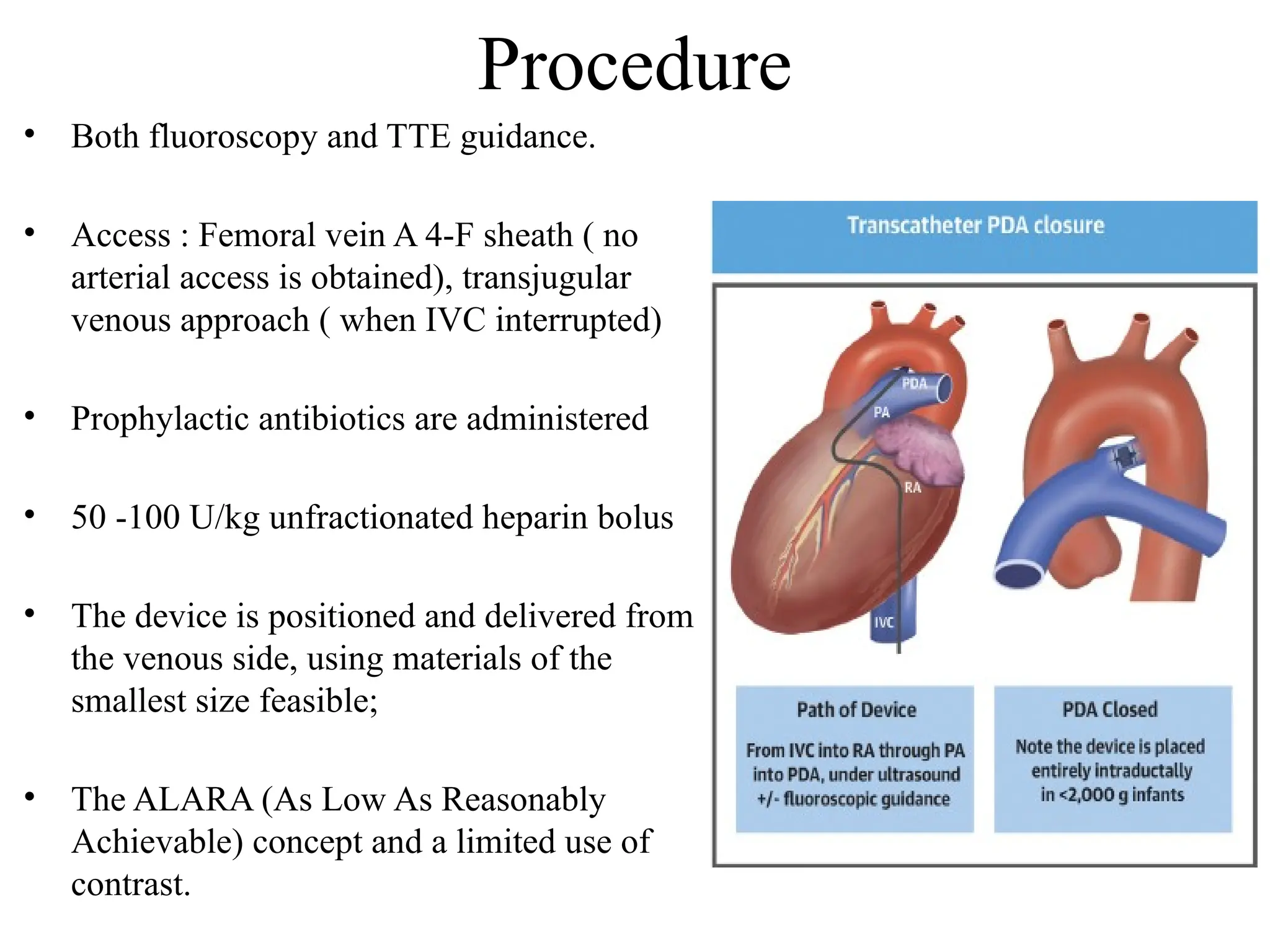 Device Closure of Hemodynamically Significant Patent Ductus Arteriosus.pptx