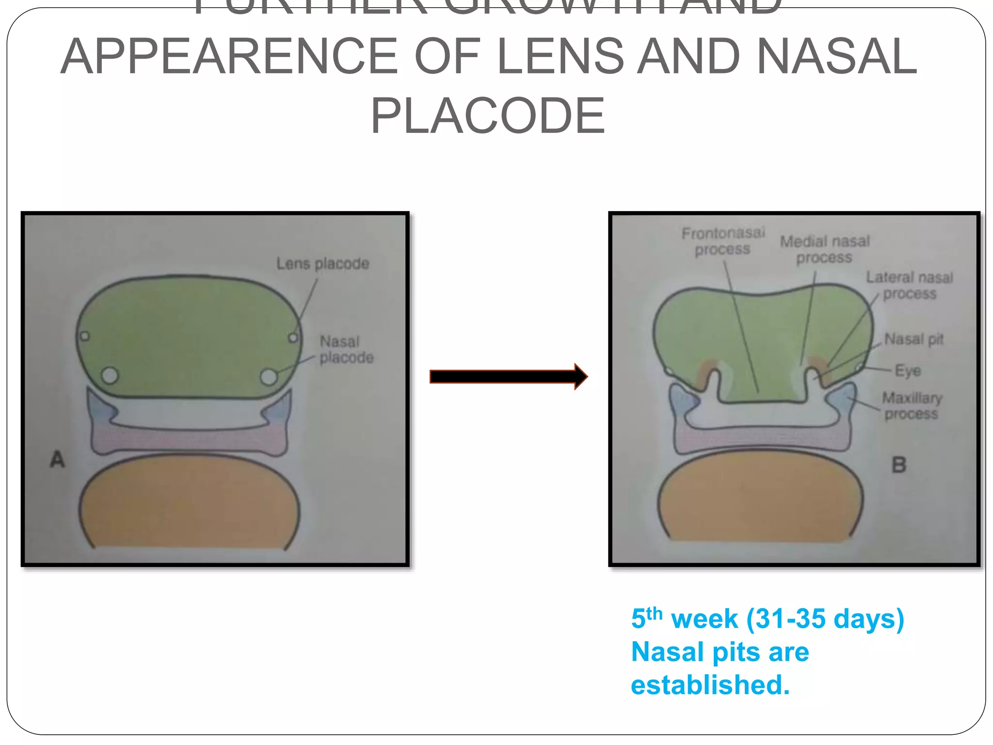 Devlopment of face and its abnormalites | PPTX