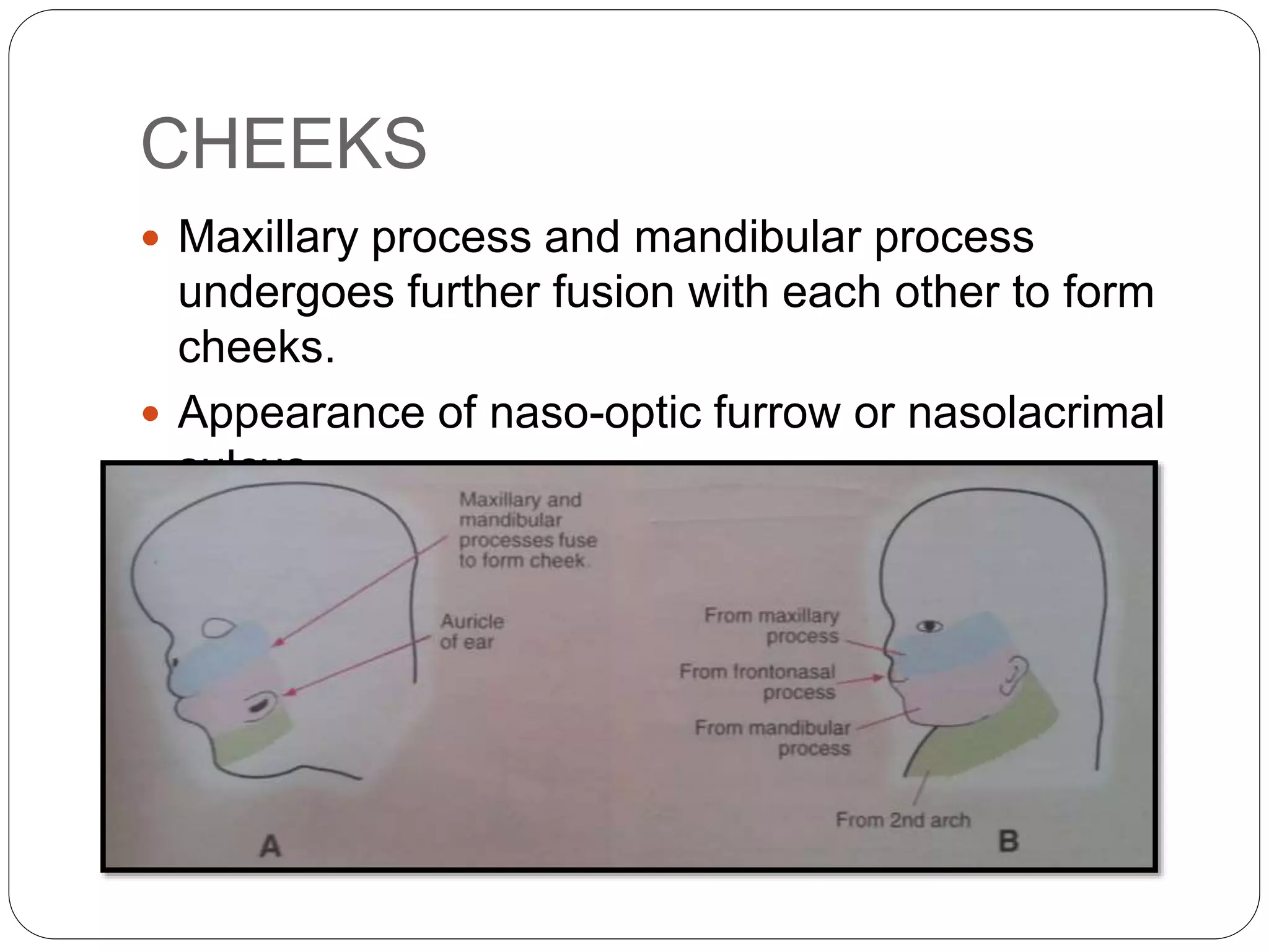 Devlopment of face and its abnormalites | PPTX