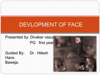 Devlopment of face and its abnormalites | PPTX