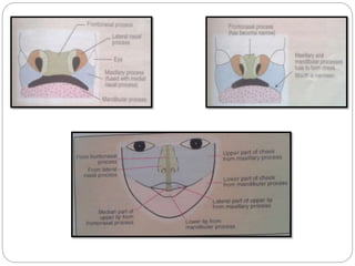 Devlopment of face and its abnormalites | PPTX