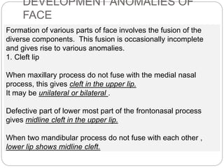 Devlopment of face and its abnormalites | PPTX