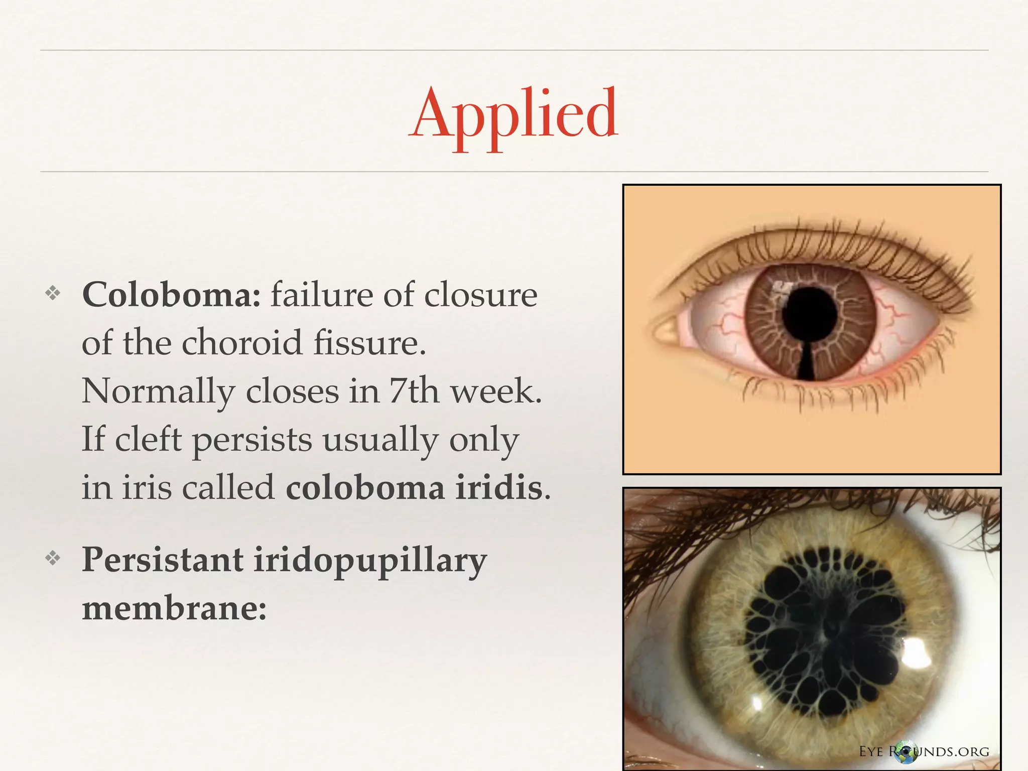 Development of eye | PDF
