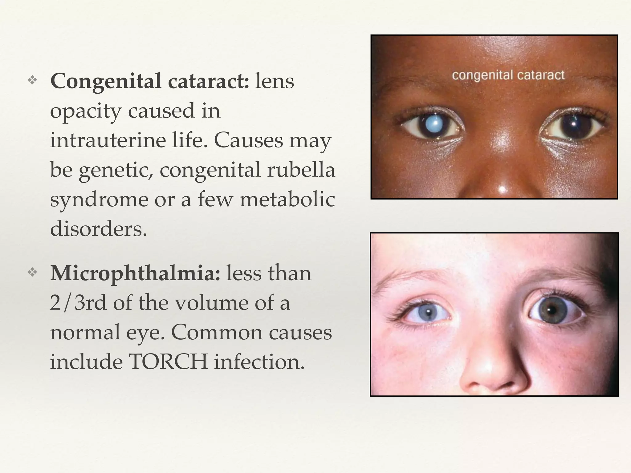 Development of eye | PDF