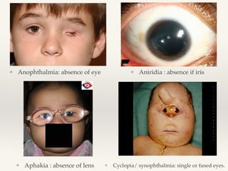 Development of eye | PDF