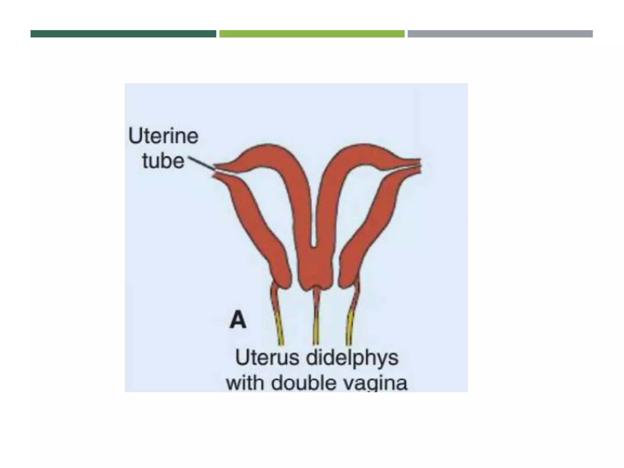 Development of the female reproductive system | PPTX