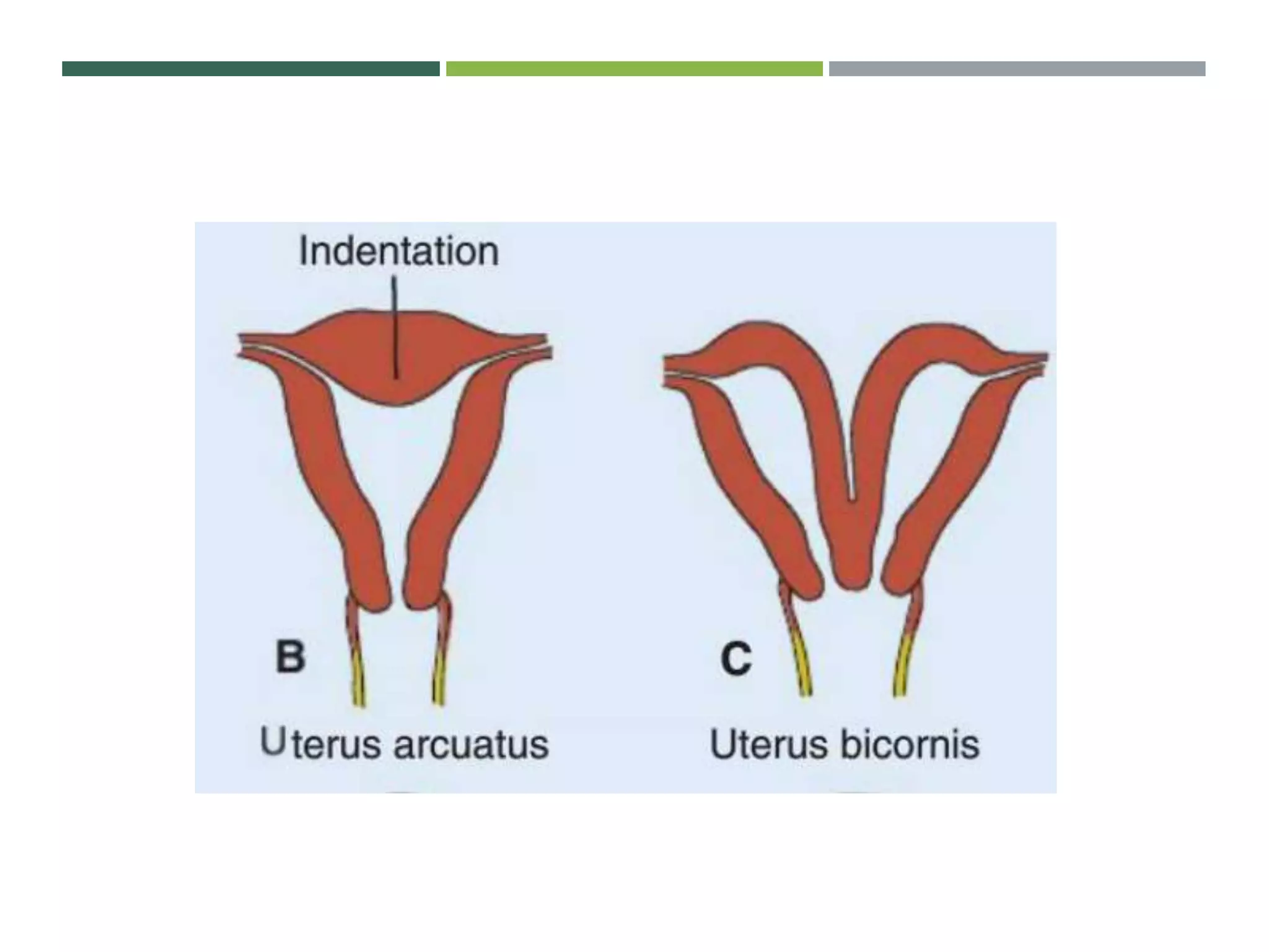Development of the female reproductive system | PPTX