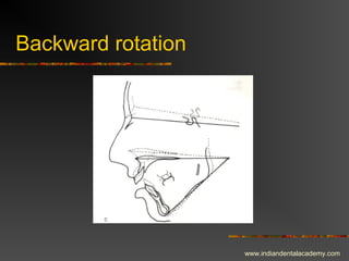 Development of occlusion /certified fixed orthodontic courses by Indian ...