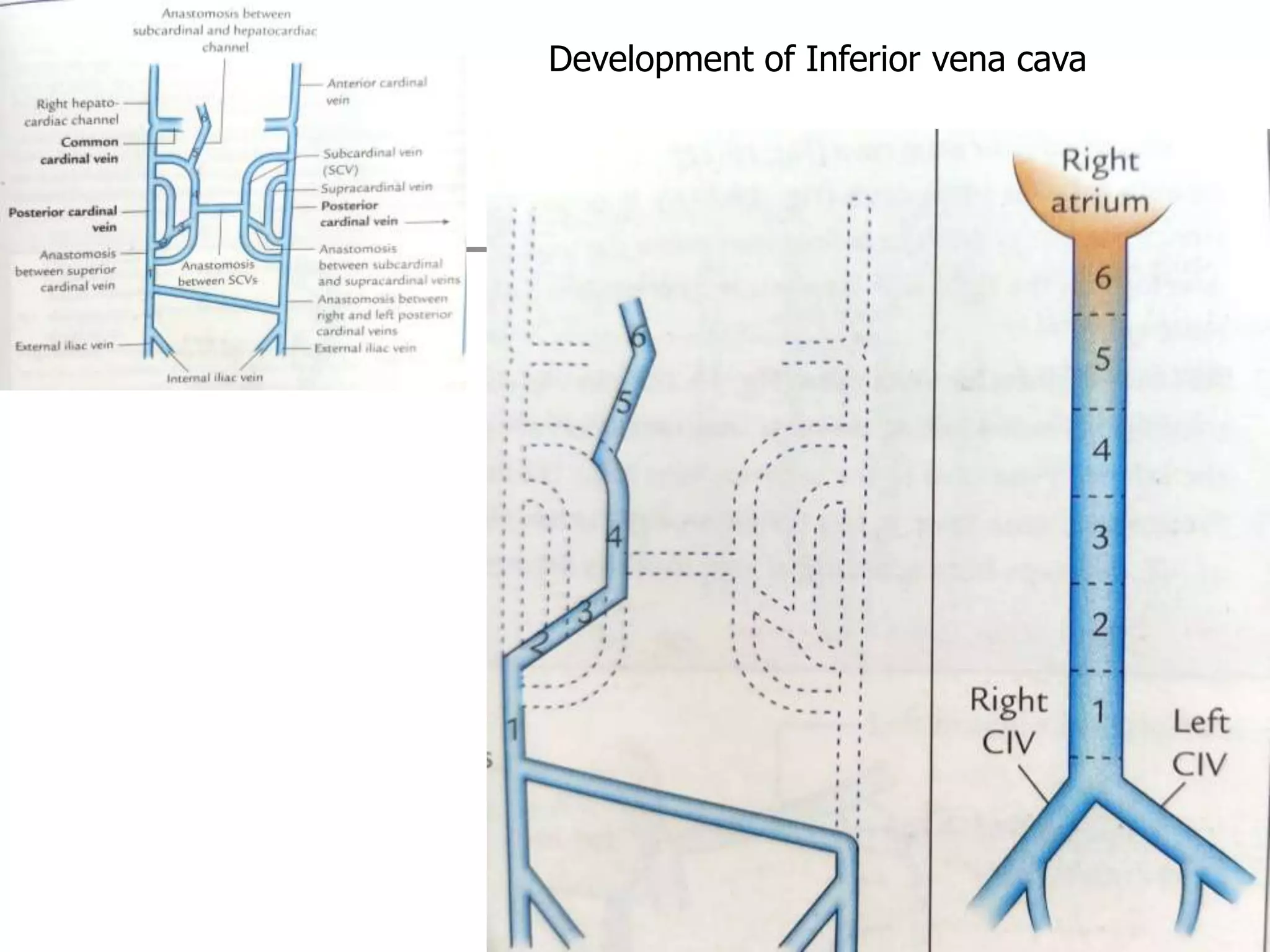 Development of Major Vessels. | PPT