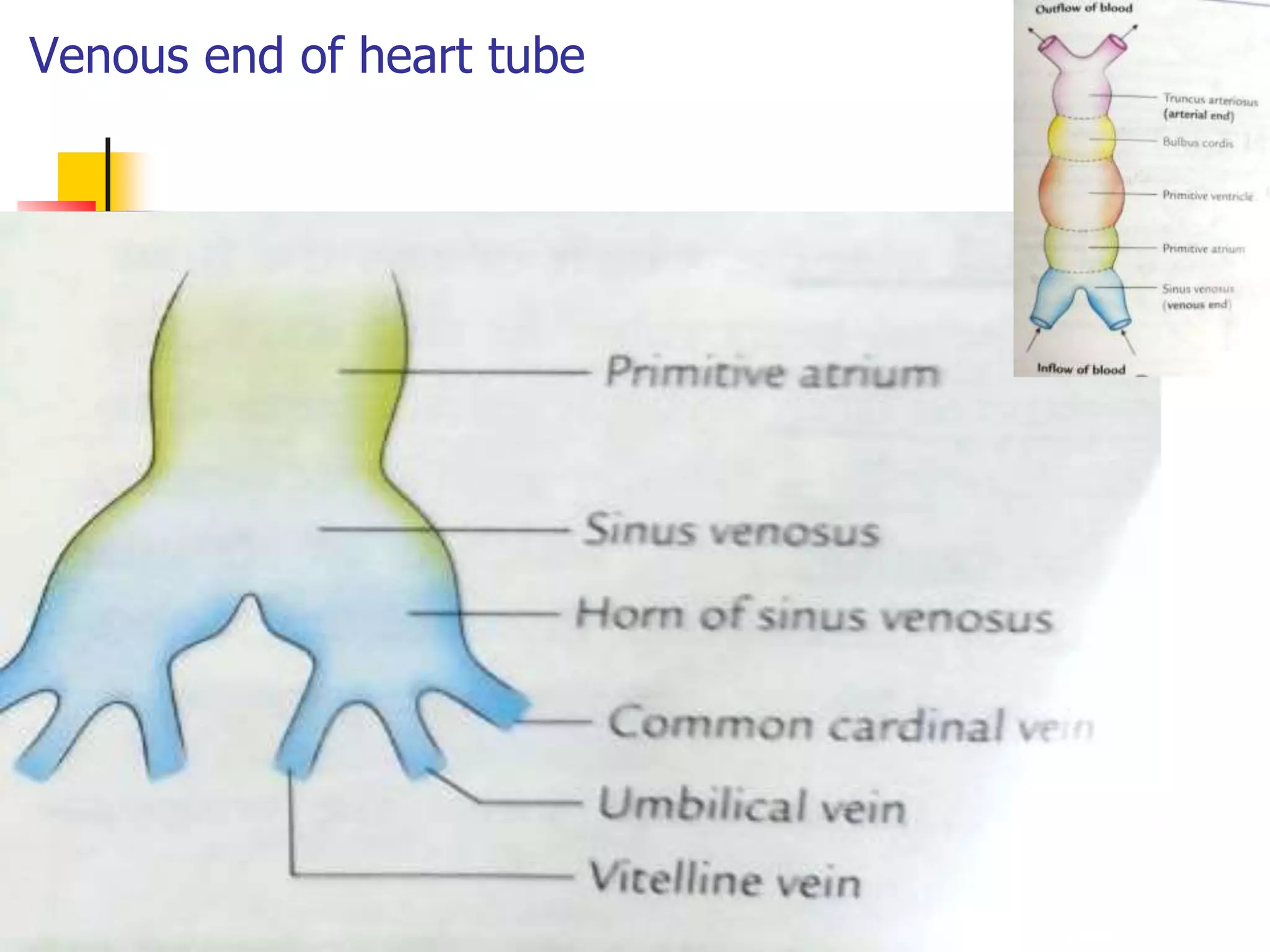 Development of Major Vessels. | PPT