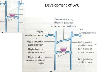 Development of Major Vessels. | PPT